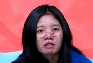 Wajah Tetiba Berjerawat Parah, Mantan Ojol Ismi Hidayah Tetap Semangat ...